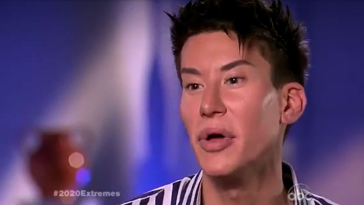 Llegó el novio de Barbie: más de 90 operaciones para ser Ken