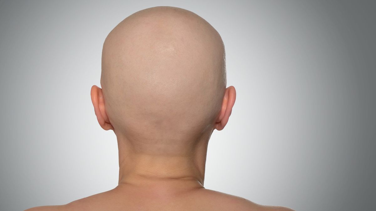 Calvicie en la mujer: ¿Cuándo y por qué?