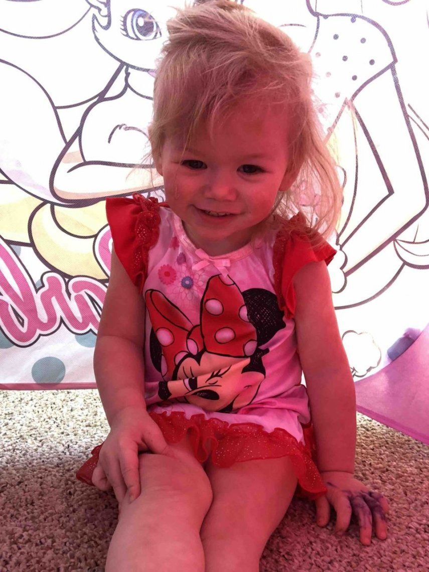 El extraño caso de Ivy Angerman, la beba que es alérgica al agua y a ...