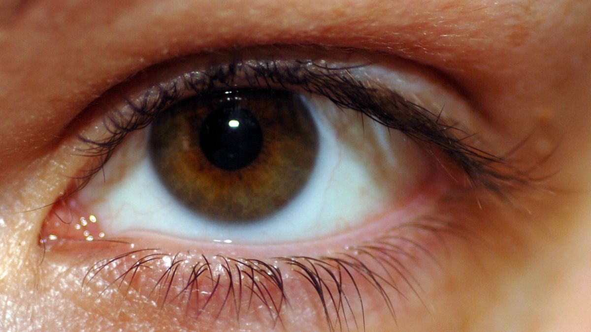 Las causas de la ceguera se pueden prevenir