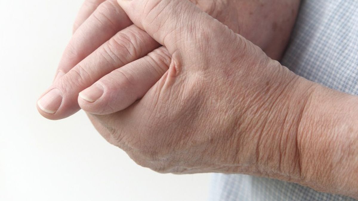 Esclerodermia: cuando las manos se vuelven azules