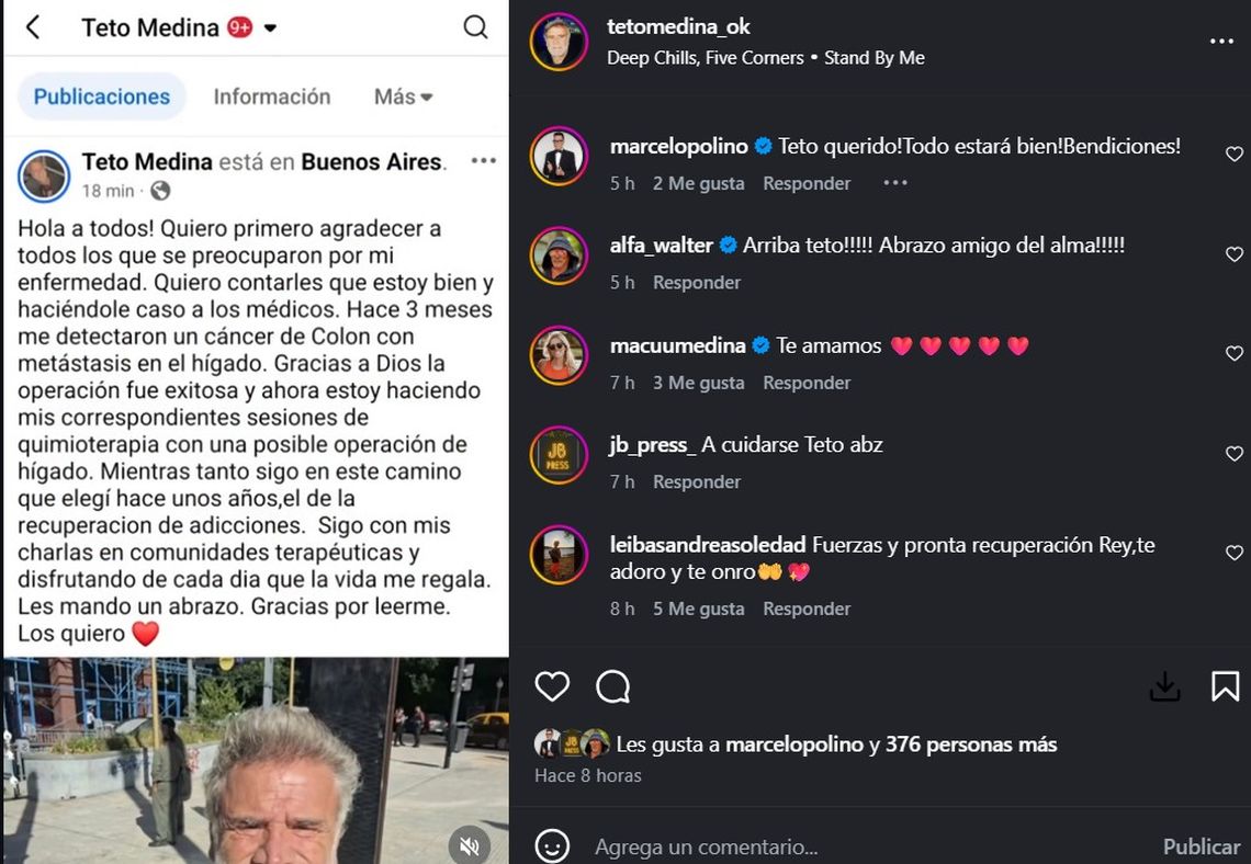 El drama de Teto Medina: Hace 3 meses me detectaron un cáncer de colon